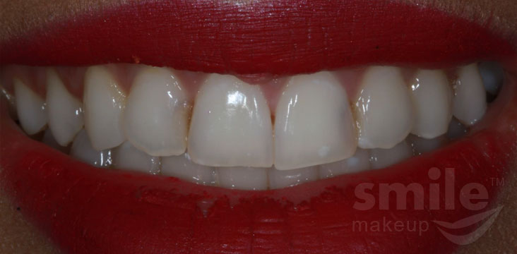Smile Makeup