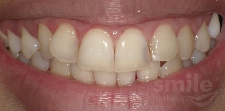 Smile Makeup